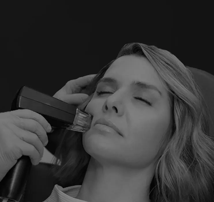 MORPHEUS FACE/BODY, LUMECA IPL & FORMA | Fix Me Up Medical Spa